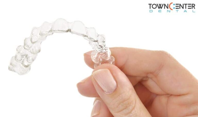 9 Steps Of An Invisalign Treatment